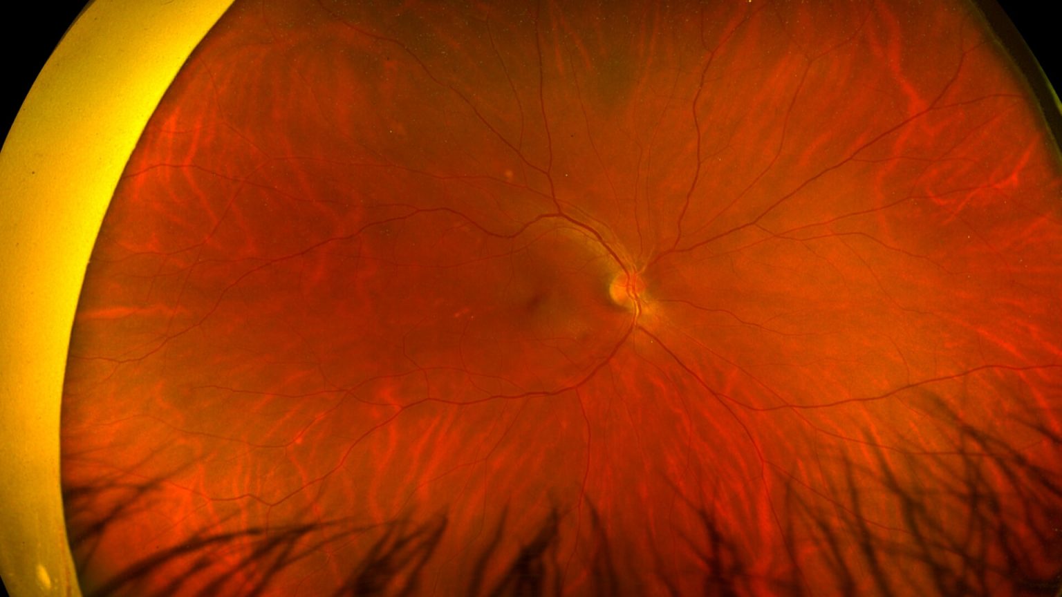 Queensland Eye & Retina Specialists | Brisbane Ophthalmologists